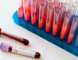 Attractive Prices And Plenty Of Upside Make These 2 “Cutting Edge ...